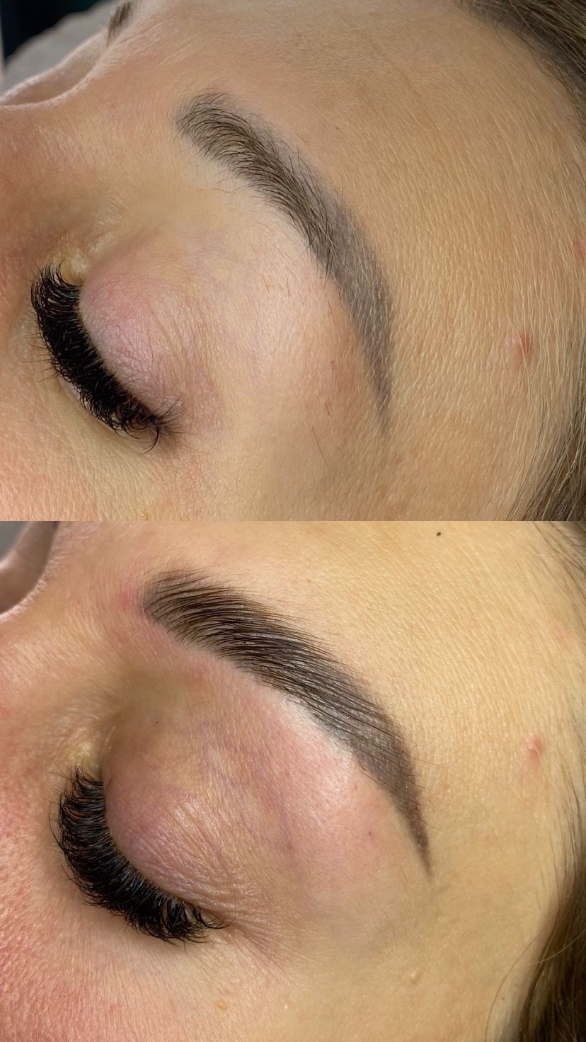 Brow lift + botox + farbanje obrva - Beauty and nutrition, Beograd ...