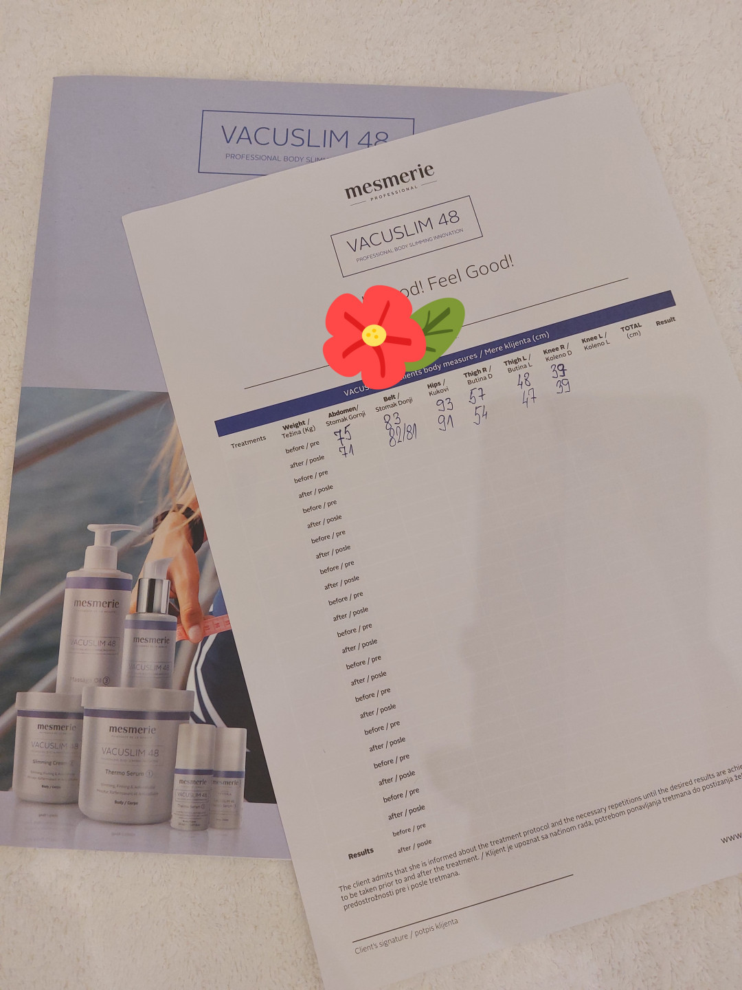 Vacuslim48 - Viva Derm, Beograd Tretmani za mršavljenje #W28YYD - SrediMe